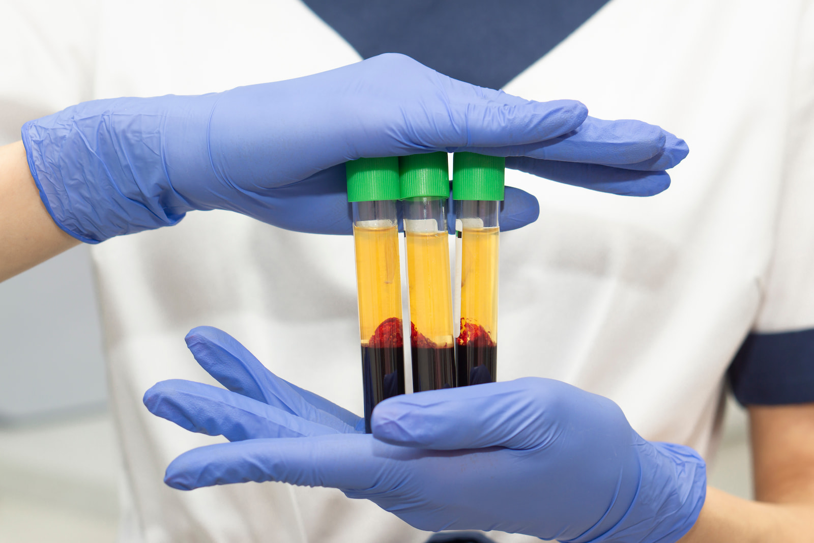 Blood vs. Plasma Donation: Key Differences - KEDPLASMA WORLD